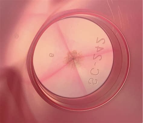 Plet 222 Lecture 13 Defects Color Streaks Flashcards Quizlet