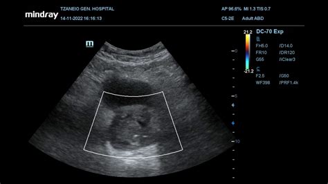 Ultrasound Journal 14 Basic And Advanced Ultrasonographic Techniques For Evaluation Of