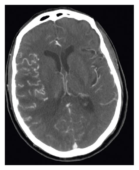 During Readmission Five Months After The Initial Referral Consecutive Download Scientific