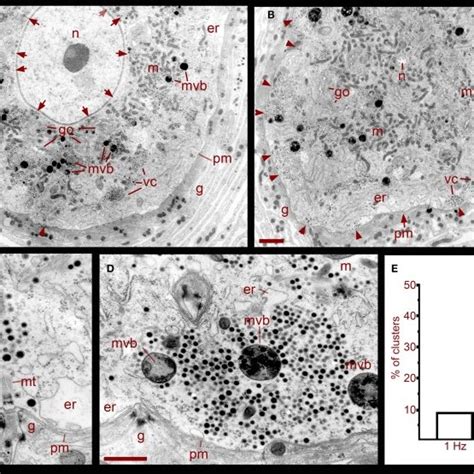 Perinuclear Multivesicular Bodies A Multivesicular Bodies Mvb