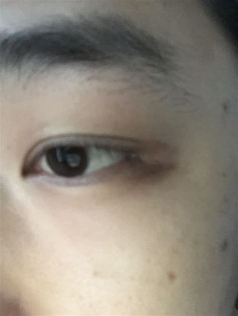 内眼角发黑图片 眼角发紫图片 伤感说说吧