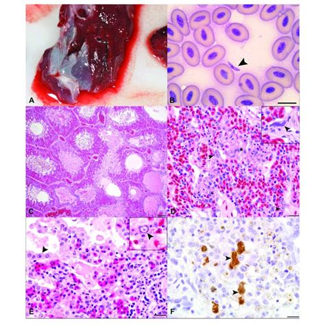 Gross Cytological Histopathologic And Immunohistochemical Features