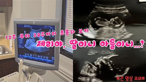 12주~20주 초음파 보는 날 아기 성별 확인 Youtube