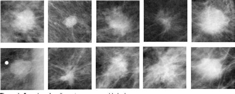 Figure 1 From Geared Rotationally Identical And Invariant Convolutional Neural Network Systems