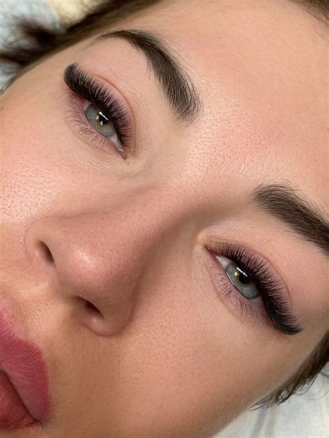 Lip Enhancement Artofit