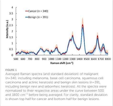 Figure 1 From Improving Skin Cancer Detection By Raman Spectroscopy