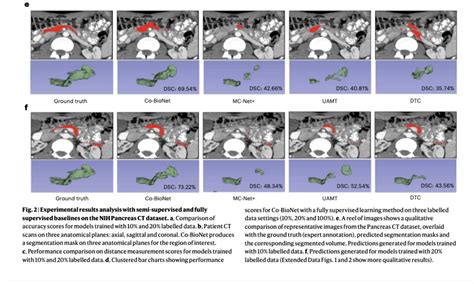Meet Co Bionet Monash Universitys Adversarial Ai System Revolutionizing Medical Image Analysis