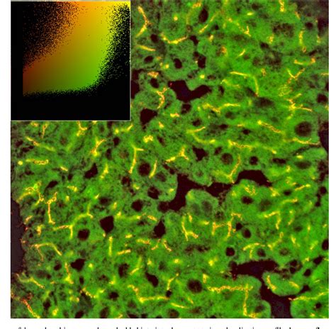 Figure 2 From Quantitative Colocalization Analysis Of Multicolor Confocal Immunofluorescence