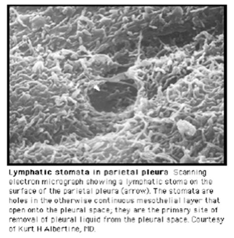 The Pleural Space And Pleural Diseases Flashcards Quizlet