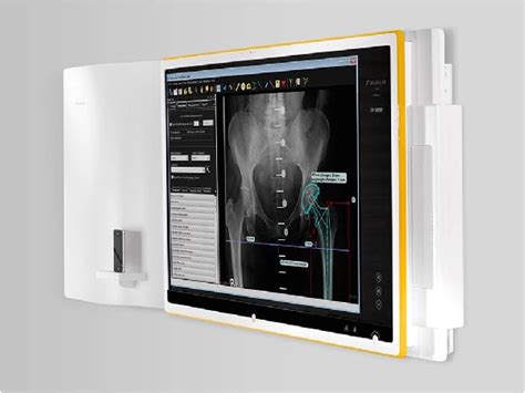Orthopedic Templating Software Williamson
