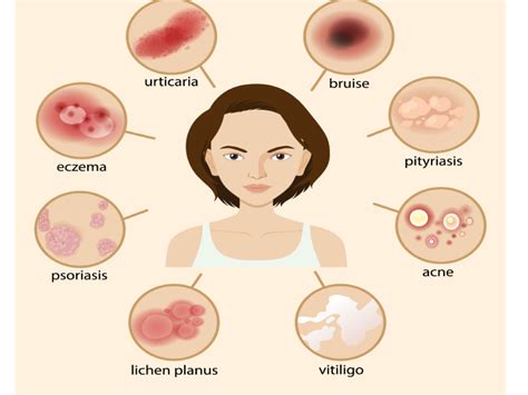 Ayurvedic Treatment For Skin Problems Aim Ayurveda