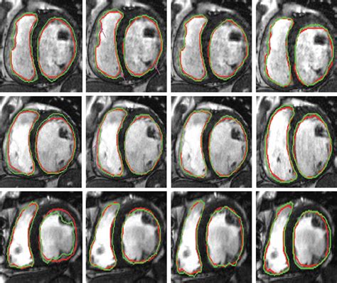 Segmentation Results For Different Methods Each Row Shows Results Of Download Scientific