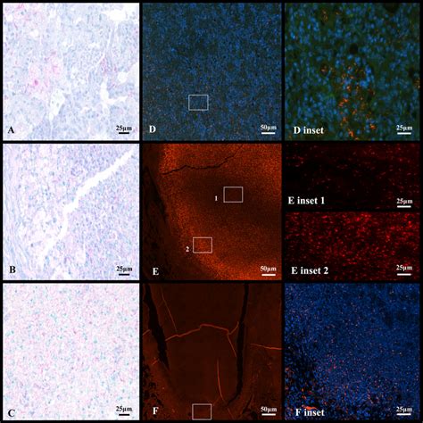 Different Staining Techniques Reveal Phenotypic Differences In Bacilli