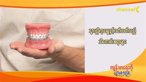 ကျန်းမာရေးကိုဂရုစိုက်ကြစို့ အပိုင်း ၃၄ သွားညှိကုသမှုများနှင့်ပတ