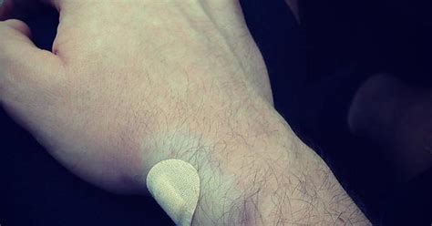 Cortisone Shot In My Right Wrist Fighting With My Girlfriend And Im Right Handedfml Imgur