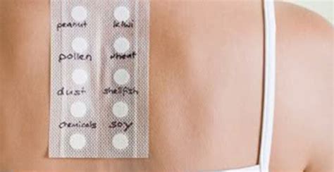 Patch Test Allergologia E Test Allergologici A Lecco E Merate