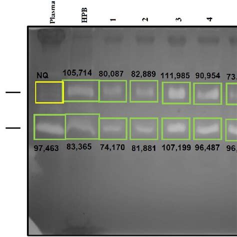 Caption Of The Imagej Program Download Scientific Diagram