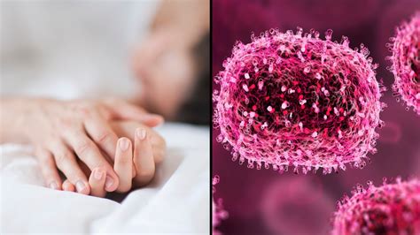 People Warned About Having Sex As UK Prepares For First Mpox Cases