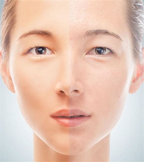 15 Simple And Effective Home Remedies To Treat Dehydration