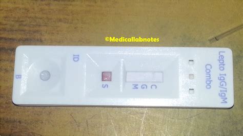 Leptospira Igm And Igg Test Introduction Test Result Test