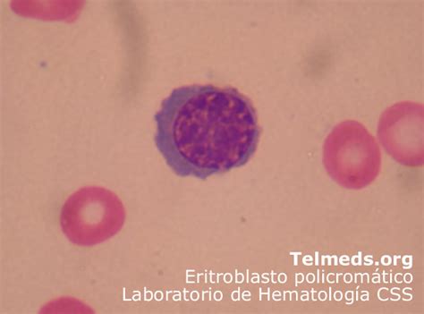 Hematologia Fichero Usac Eritroblasto Policromatófilo