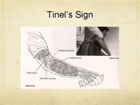 Elbow Orthopaedic Tests Medial Aspect Ulnar Nerve Medial
