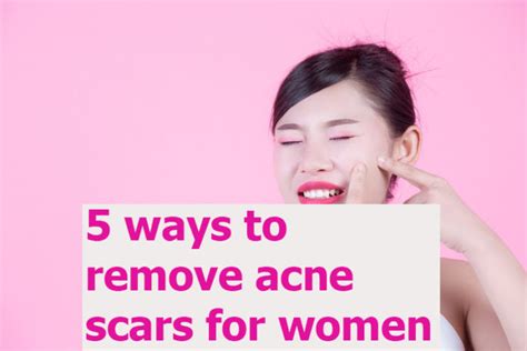 Ways To Remove Acne Scars For Women Yabibo
