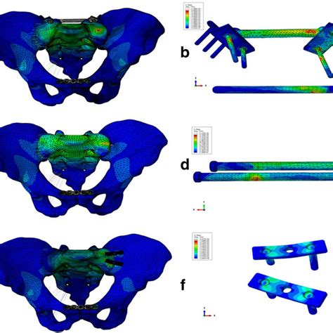 The Properties Of Materials Used In Pelvic Finite Element Model Download Table