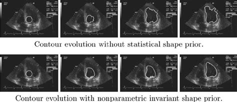 Segmentation Of The Left Ventricle In Cardiac Ultrasound Images The Download Scientific