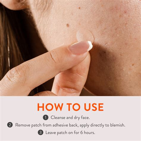 Salicylic Acid Spot On Acne Treatment Patches Acnefree Dermatology