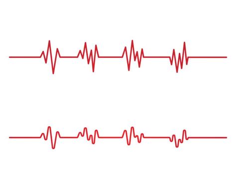 Echocardiogram Illustrations Royalty Free Vector Graphics And Clip Art