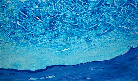 Mucoderm® Botiss Biomaterials Klockner