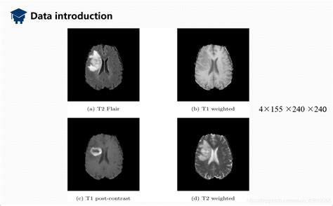 3d Mri Brain Tumor Segmentation Using Autoencoder Regularizationtingting张的博客 Csdn博客