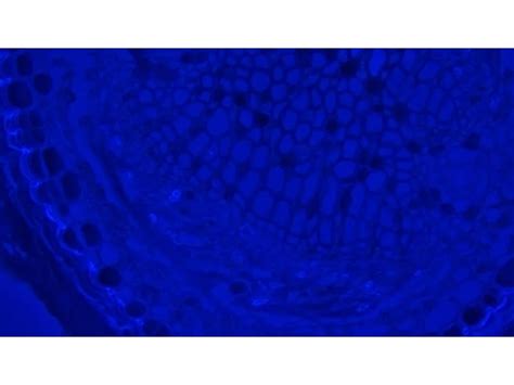 Olympus Bx46f Upright Fluorescence Microscope New Filters