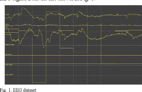 figure 1 from reconstruction and denoising of eeg signal using