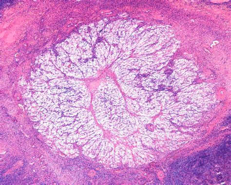 Regression Of Corpus Luteum Light Micrograph Stock Image C0580716 Science Photo Library