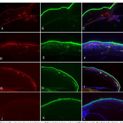 Figure 3 From Inhibition Of Mouse Alkali Burn Induced Corneal Neovascularization By Recombinant