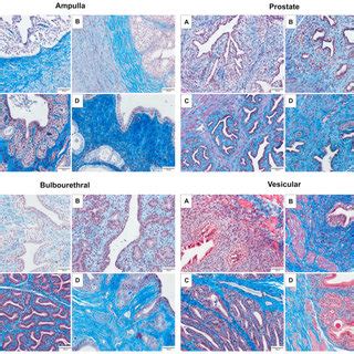 Immunolabeling of ER α in the accessory sex glands of the fetus A Download Scientific Diagram