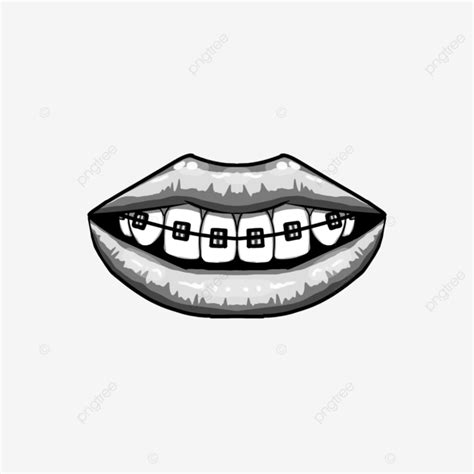 Black And White Mouth With Braces Cartoon Illustration Braces Mouth