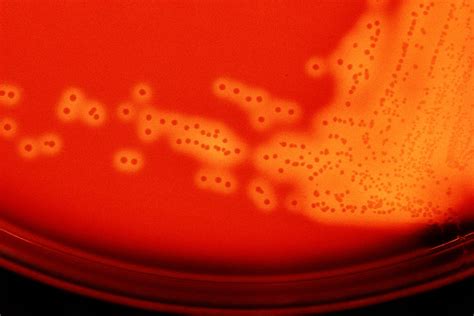 Streptococcus Pyogenes Atelier Yuwaciaojp