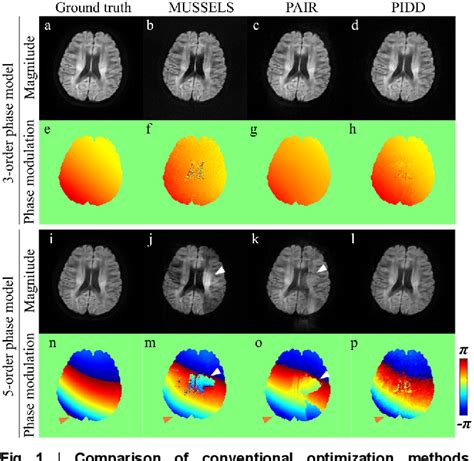 Figure From Physics Informed Deep Diffusion MRI Reconstruction Break Training Data Bottleneck