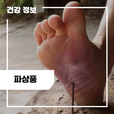 파상풍 초기증상 및 원인 치료 방법 성인 파상풍 예방접종 네이버 블로그