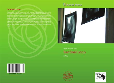 Sentinel Loop 978 613 9 00237 5 6139002370 9786139002375 Sentinel Loop 978 613 9 00237 5 6139002370 9786139002375