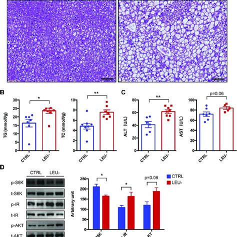 intermittent leucine deprivation aggravates hepatic steatosis in db db
