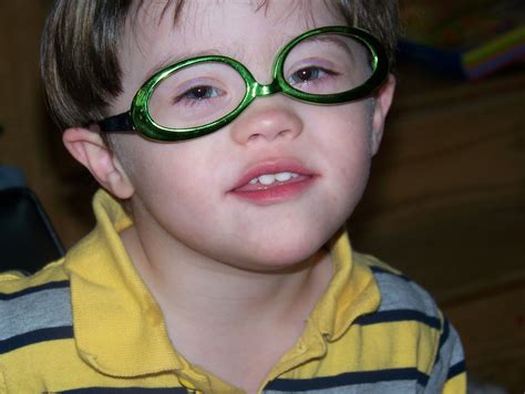 Down Syndrome Actor Glasses