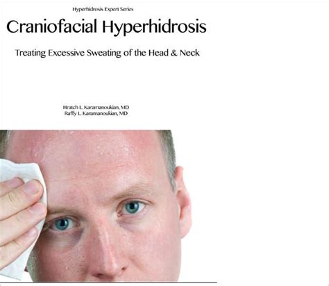 Craniofacial Hyperhidrosis Treating Excessive Sweating Of The Head And