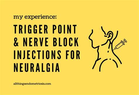Trigger Point Nerve Block Injections For Neuralgia My Experience
