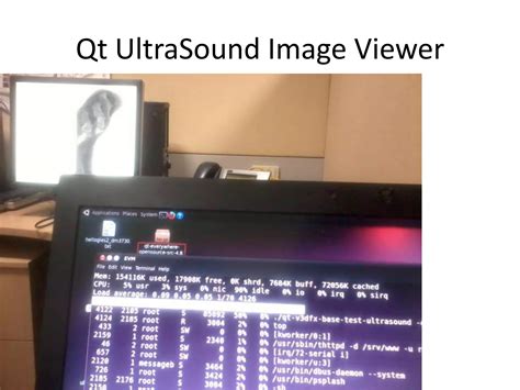 Ultrasound Image Viewer Qt Sgx Pptx