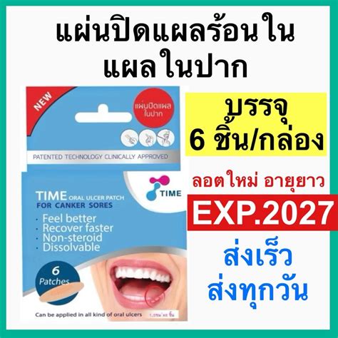 แผ่นแปะร้อนใน Time Oral Ulcer Patch แผ่นปิดแผลในปาก แผลร้อนใน Canker