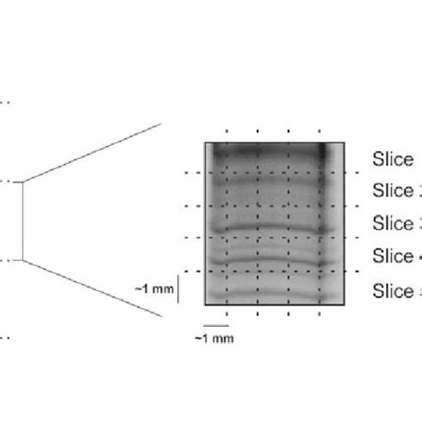 Immunoblot Analysis Of Optiprep Density Gradient Purified Fractions Download Scientific